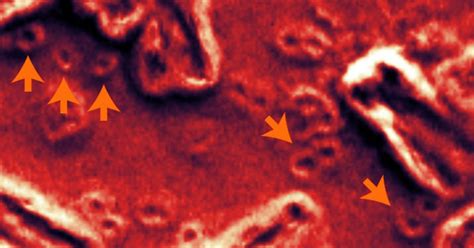 Uc San Diego Researchers Help Discover That Tiny Dna Circles Are Key Drivers Of Cancer