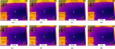 Figure 16 From An Investigation Of Implantable Capacitive Coupling Intra Body Power Transfer