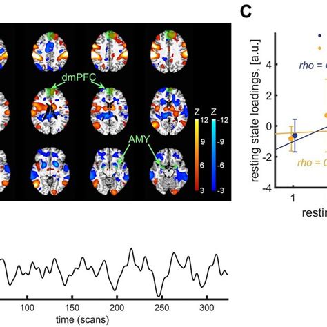 Spatiotemporal Pattern Associated With Progressive Increase Of