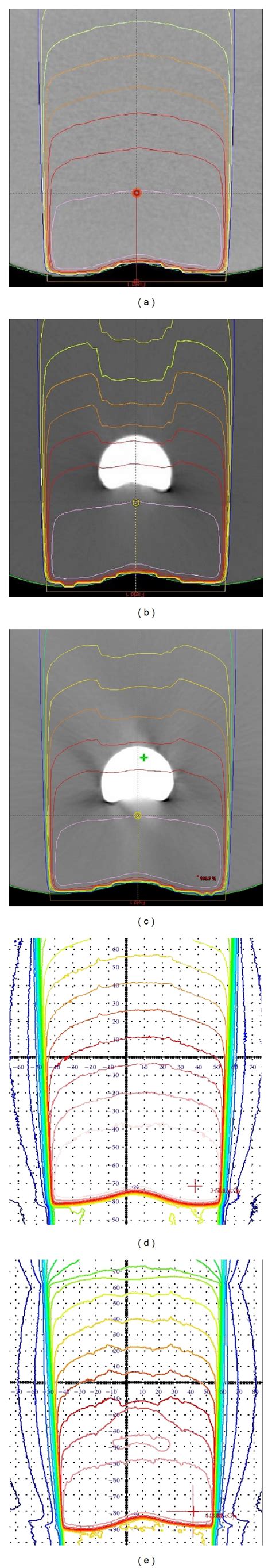 The Calculated Dose Distribution Maps Using Rtps And The Dose