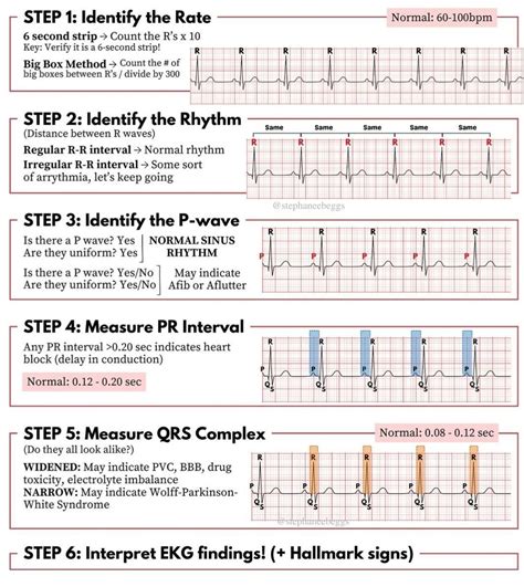 Ecg Review I Medizzy