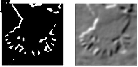 Laplacian Of Gaussian