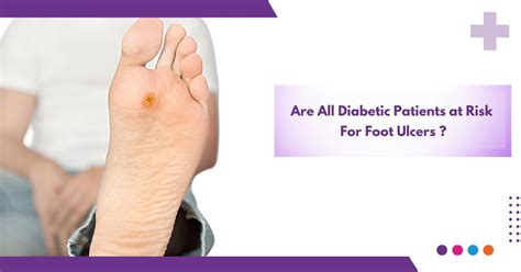 Are All Diabetic Patients At Risk For Foot Ulcers