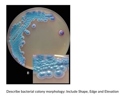 Solved Describe Bacterial Colony Morphology Include Shape