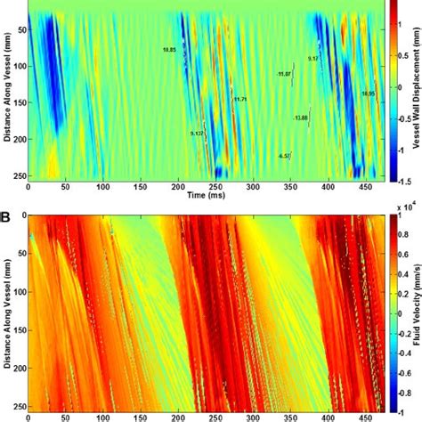 Spatiotemporal Maps From The Straight Geometry Aorta A Vertical Download Scientific Diagram