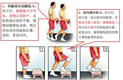 术后康复训练示意图流图大山谷图库