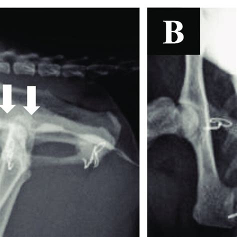 Retrograde Urethrography Showed A Stricture Of The Pelvic Urethra Download Scientific Diagram