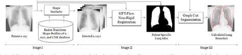 Figure 1 From Lung Segmentation In Chest Radiographs Using Anatomical Atlases With Nonrigid