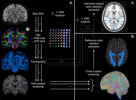 Overview Of The Complete Dmri Analysis Pipeline A Individual Dmri Download Scientific Diagram