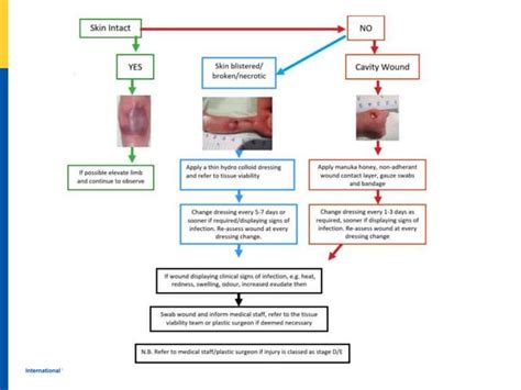 Algorithm Of Contrast Extravasation 1 Pptx