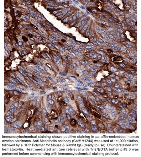 Anti Mesothelin Rabbit Monoclonal Ab H1244 Genuin Biotech