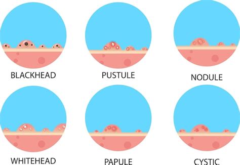 Page 9 Direct Skin Vectors And Illustrations For Free Download