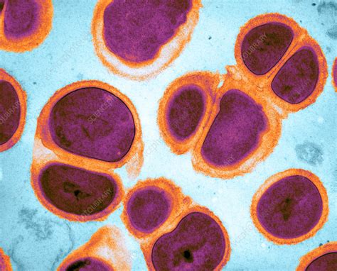 Neisseria Gonorrhoeae Microscope