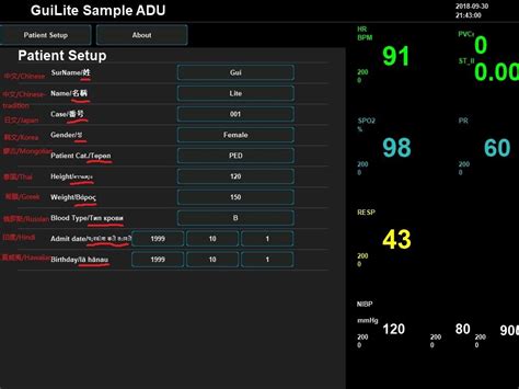 跨平台轻量级gui库guilite详解 Csdn博客