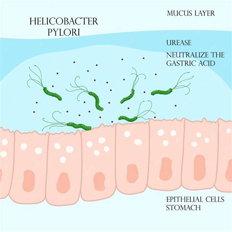 Premium Vector Helicobacter Pylori In Mucosal Layer On Epithelial Cells In Stomach