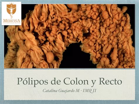 Pólipos De Colon Y Recto Pdf