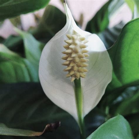 How To Tell When You Are Ovulating With A Fertility Microscope