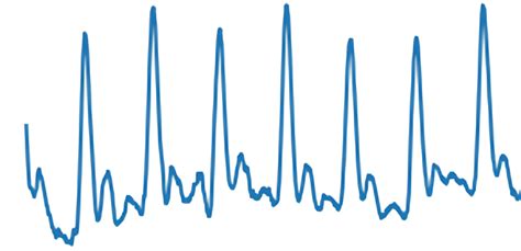 Github Jovenstrikerremovingppgmotionartifacts Multiprocessing Code To Simulate Collecting