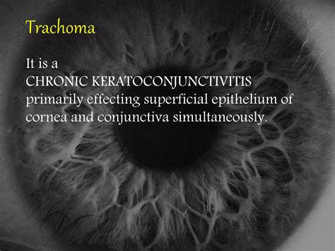 Trachoma Pptx