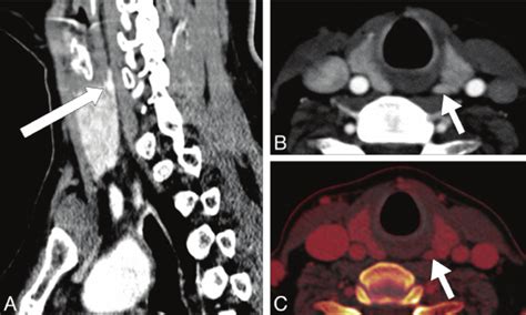 Ct Examination Of The Patient By Using Our Modified 4d Ct Protocol Download Scientific Diagram