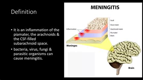 Meningitis Pptx