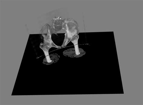 Code Logic Error In ImageReslice Js Issue 2714 Kitware Vtk Js GitHub