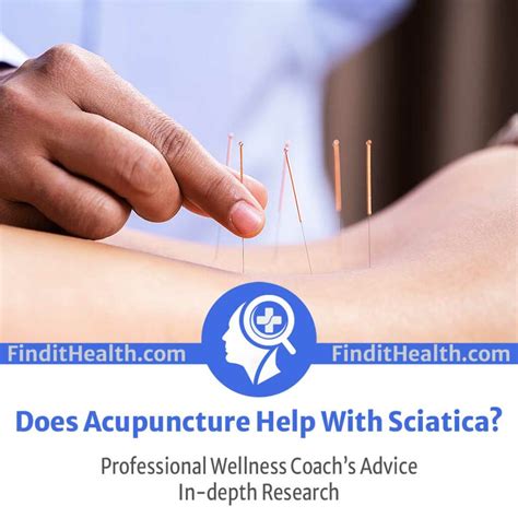 Does Acupuncture Help With Sciatica Health Coachs Advice