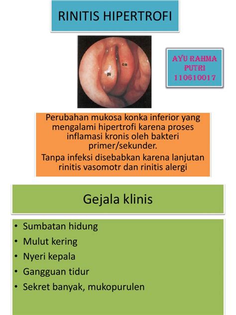 Rinitis Gejala Diagnosis Dan Terapi Pdf Kesehatan Holistik