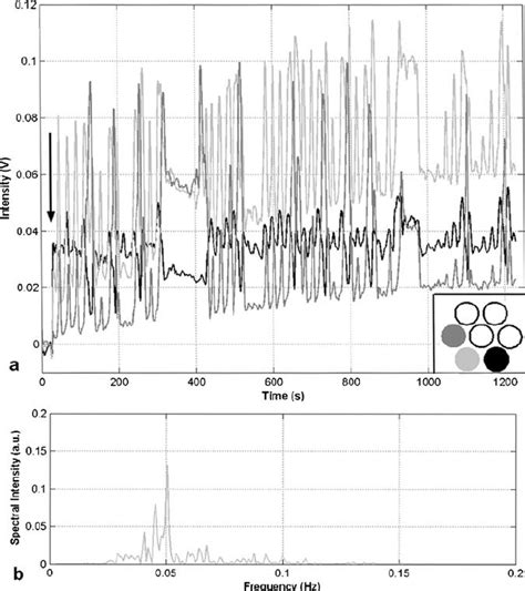 Magnetic Signals Recorded Concomitantly To The Ingestion Of The Enteric Download Scientific