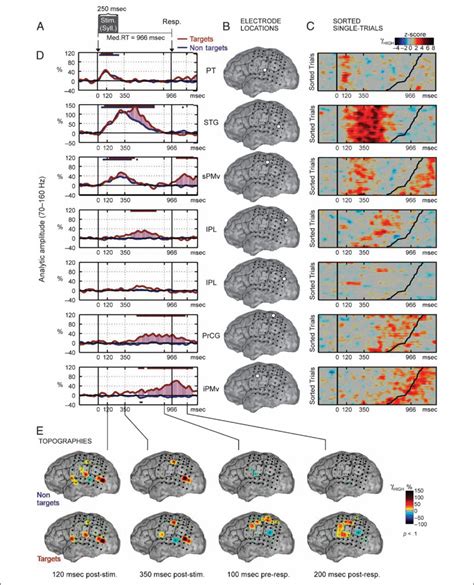 Cortical Spatio Temporal Dynamics Underlying Phonological Target Detection In Humans Abstract