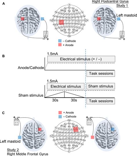 Figure 1 From Transcranial Direct Current Stimulation Tdcs Targeting The Postcentral Gyrus