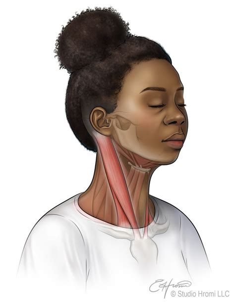 Sternocleidomastoid Anatomy Illustration By Hromi Biomedical Medical Illustration Animation