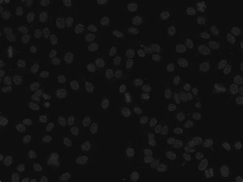 Matlab Get Regions Within Black Border Of Image Stack Overflow