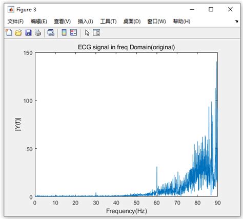 基于Matlab使用高通和低通滤波器从ECG信号中去除噪声的项目 索炜达 猿创
