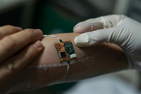 Microchip Embedded In A Human Arm Premium Ai Generated Image