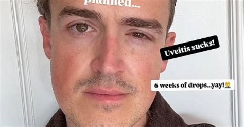 한대 맞은듯 눈 퉁퉁…방치하면 실명 이르는 ‘이 병은