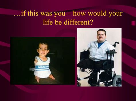 Ppt Thalidomide Powerpoint Presentation Free Download Id369426