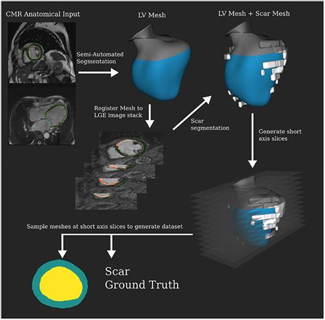 Github Sandraadel 3d Visualization Of Myocardial Scar Using Cmr Automatic Segmentation Under