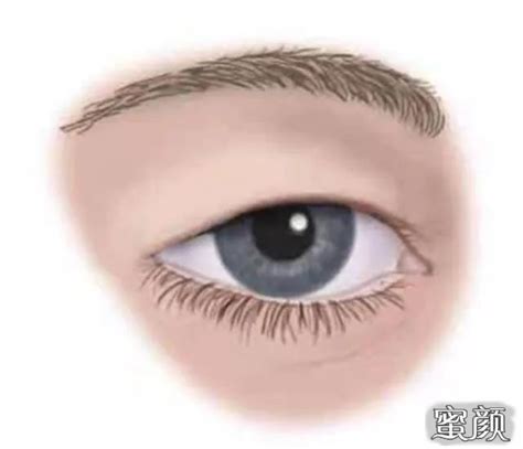 一篇文章让你看懂如何进行眼周抗衰老 蜜颜优惠