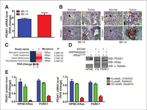 kras induces src dependent peak1 expression in pdac and other human