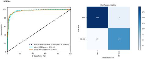 A Deep Learning Workflow For Mass Forming Intrahepatic Cholangiocarcinoma And Hepatocellular