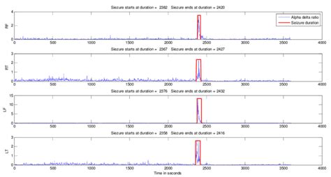 Automated Detection Of Seizure And Seizure Time Depicted In Red In