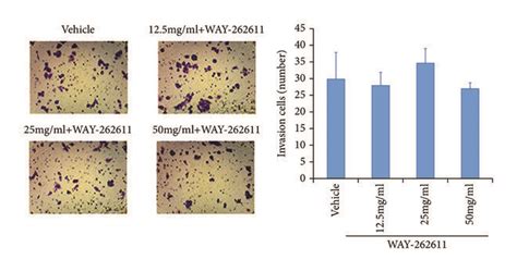 Activating Wnt β catenin pathway rescued the level of β catenin EMT