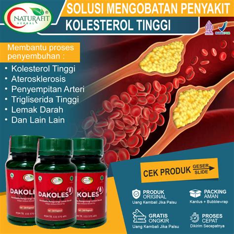 Jual Obat Kolestrol Paling Ampuh Pembersih Plak Pembuluh Darah Penyempitan Arteri Aterosklerosis