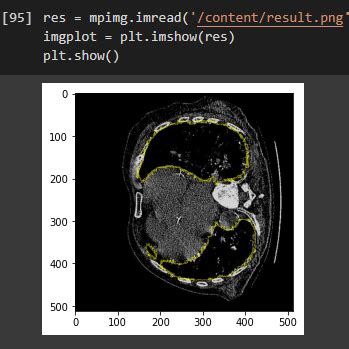 Python How To Fill Segmented Area Within A Mask In Image Segmentation Task Stack Overflow