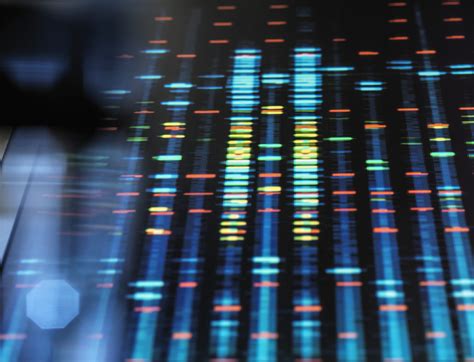 Paroxysmal Nocturnal Hemoglobinuria Risk Factors Rare Disease Advisor
