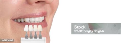 배너 치아 미백 완벽한 흰색 치아 입이 그늘 가이드 표백제 색상 여성 베니어 미소 치과 치료 및 구강학 치과 흰색 배경에 격리 복사 공간으로 닫힙니다 건강 진단에 대한 스톡