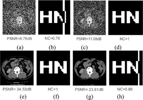Medical Images Under Common Attacks A Gaussian Noise Level Of 30 B Download Scientific