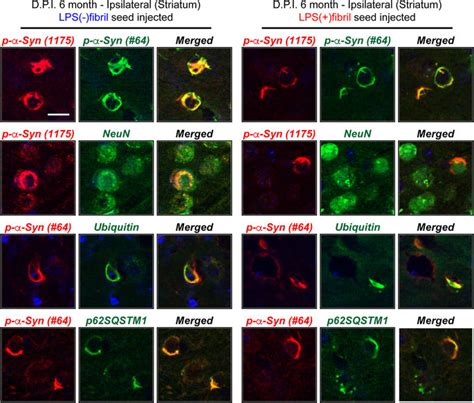 Characterization Of The Phosphorylated α Synuclein Structures In