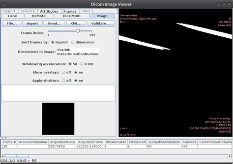 unable to load dicom segmentation file page 2 support 3d slicer